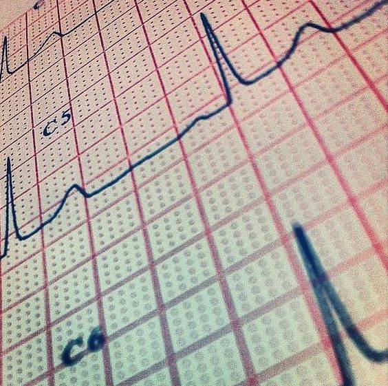 Ipswich Hearts – For Doctors and Patients